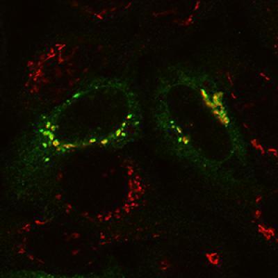 Surprising culprit found in cell recycling defect | Science Codex