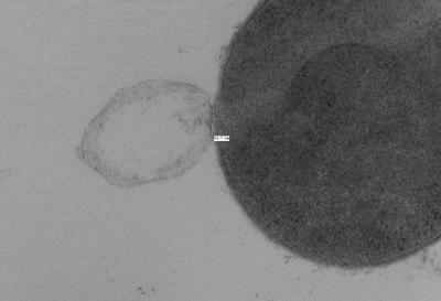 Study quantifies the size of holes antibacterials create in cell walls ...