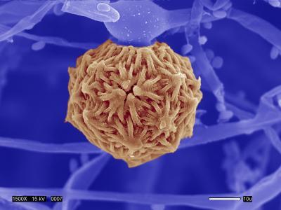Size matters -- in virulent fungal spores -- and suggests ways to stop ...