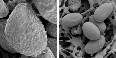 Size matters -- in virulent fungal spores -- and suggests ways to stop ...