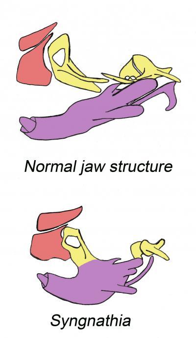 Stowers researchers announce first genetic model of a human jaw fusion ...