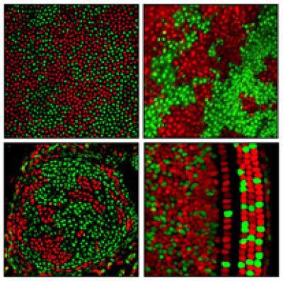 Color-coded cells reveal patchwork patterns of X chromosome silencing ...