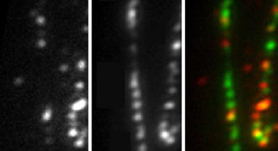 BBSome complex protects cilia from excess signaling molecules | Science ...