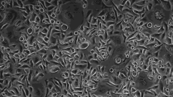 Making skin crawl: using cellular motion to help wound healing ...