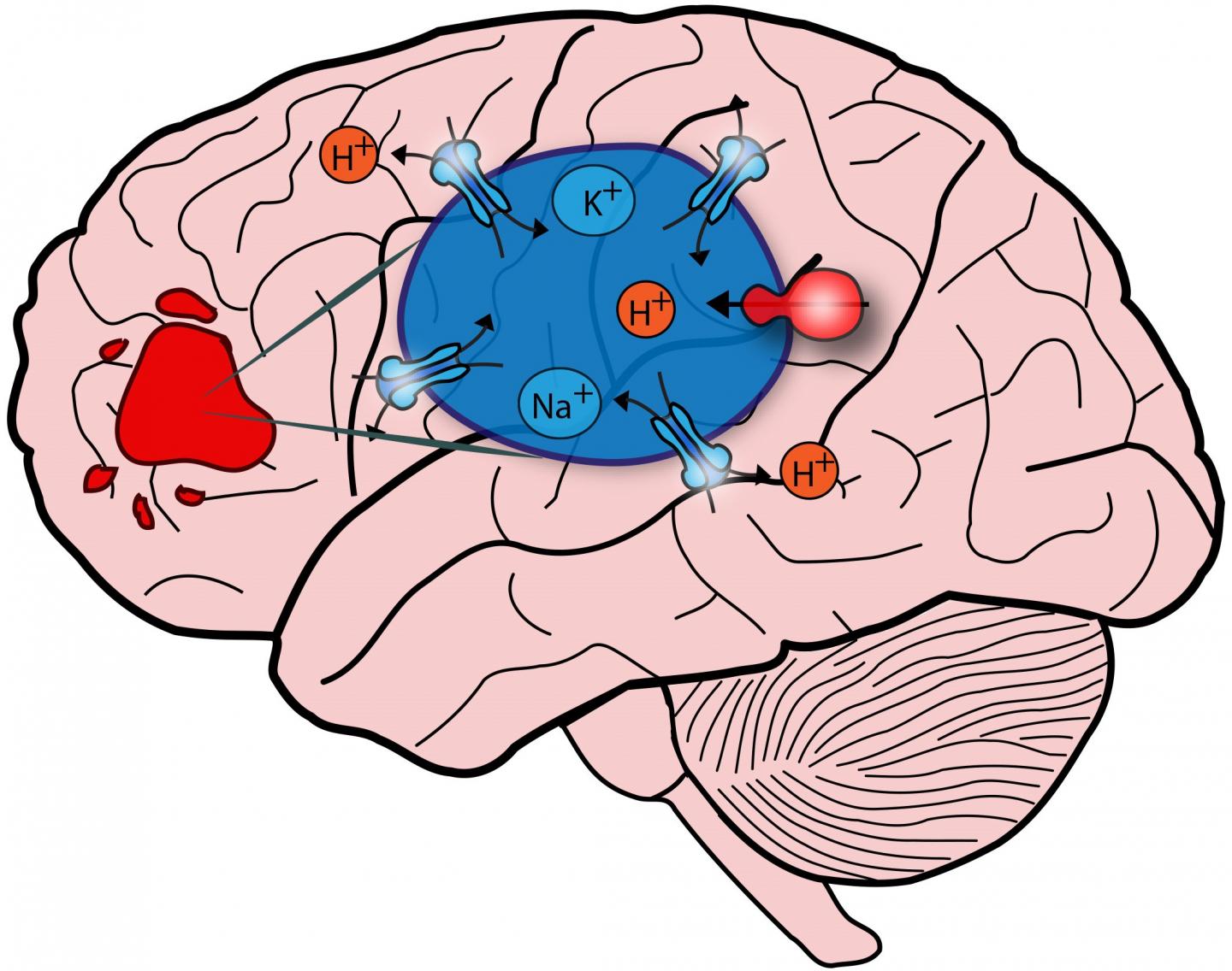 Faults In Same Protein? What Autism Can Teach Us About Brain Cancer ...
